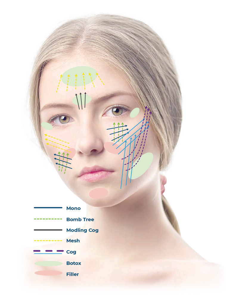 Combination Of Threads AVENTA Combination Of Threads AVENTA